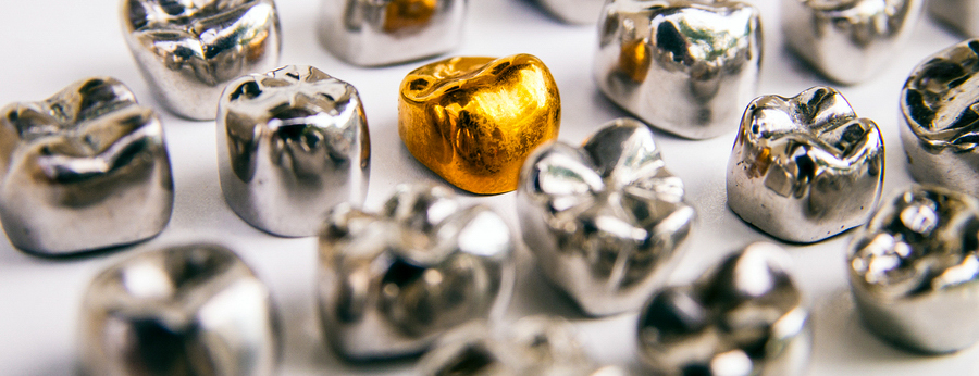 What is Dental Scrap? - Southern Dental Refining | Odessa, FL